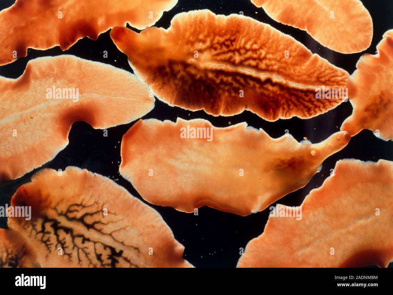 Liver flukes. Light micrograph of liver flukes, Fasciola hepatica ...