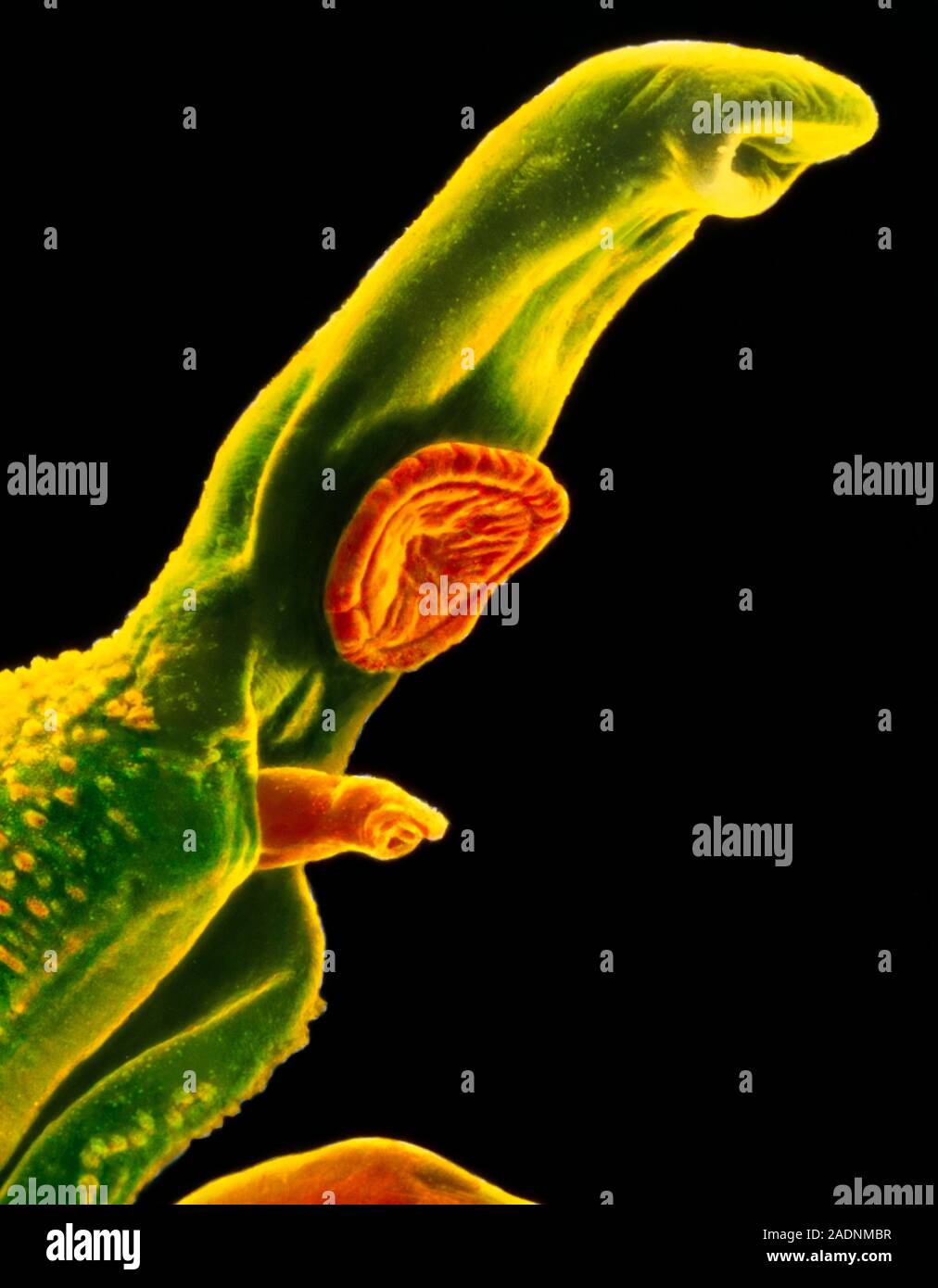 Bilharzia fluke. Coloured Scanning Electron Micro- graph (SEM) of the ...