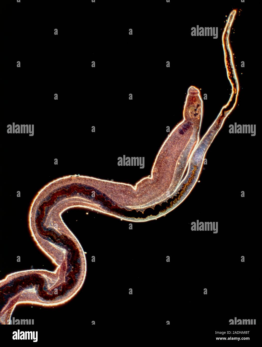 Bilharzia fluke. Light micrograph of male & female blood flukes ...