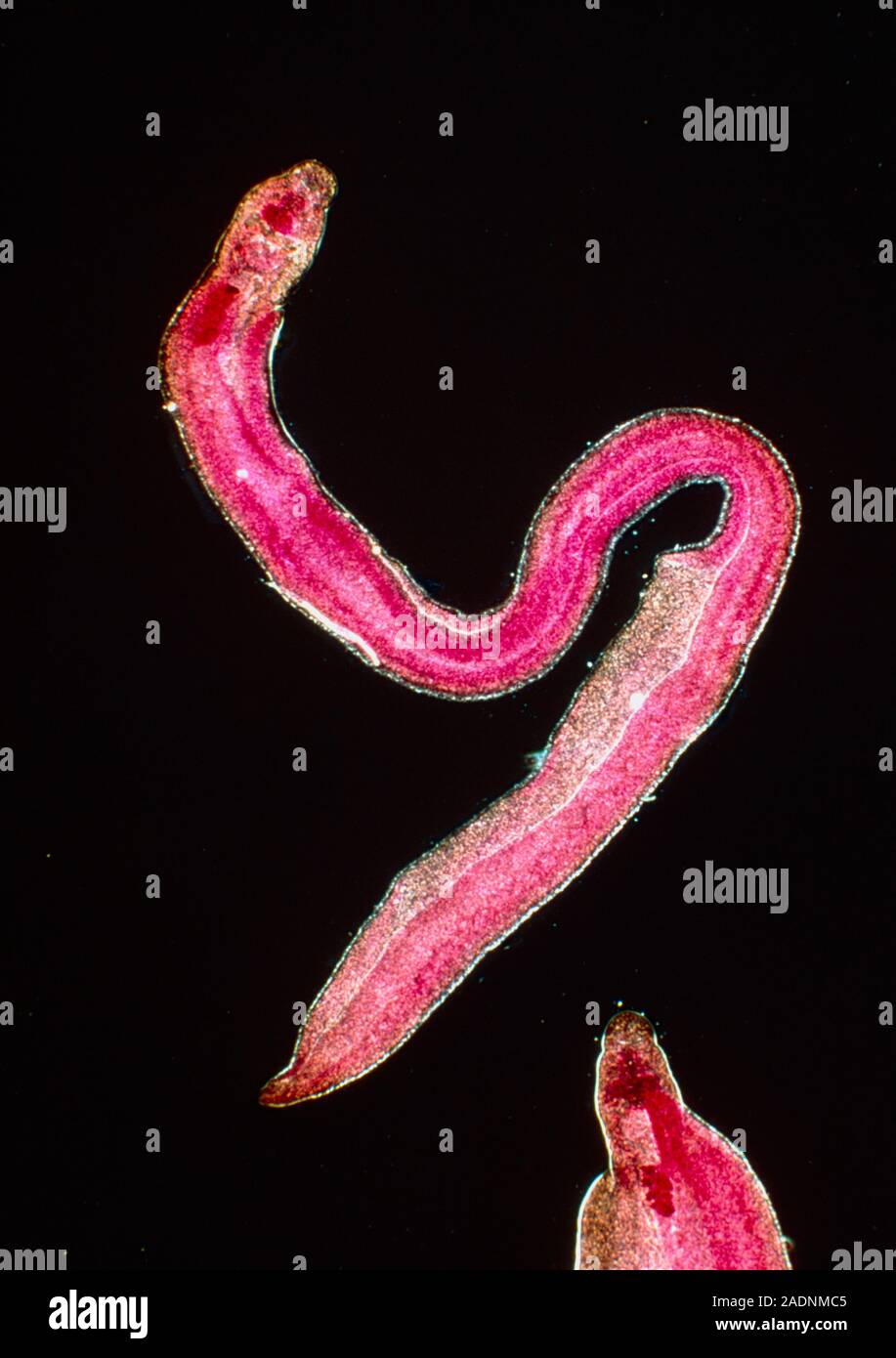 Bilharzia fluke. Light micrograph (LM) of an adult male fluke of ...