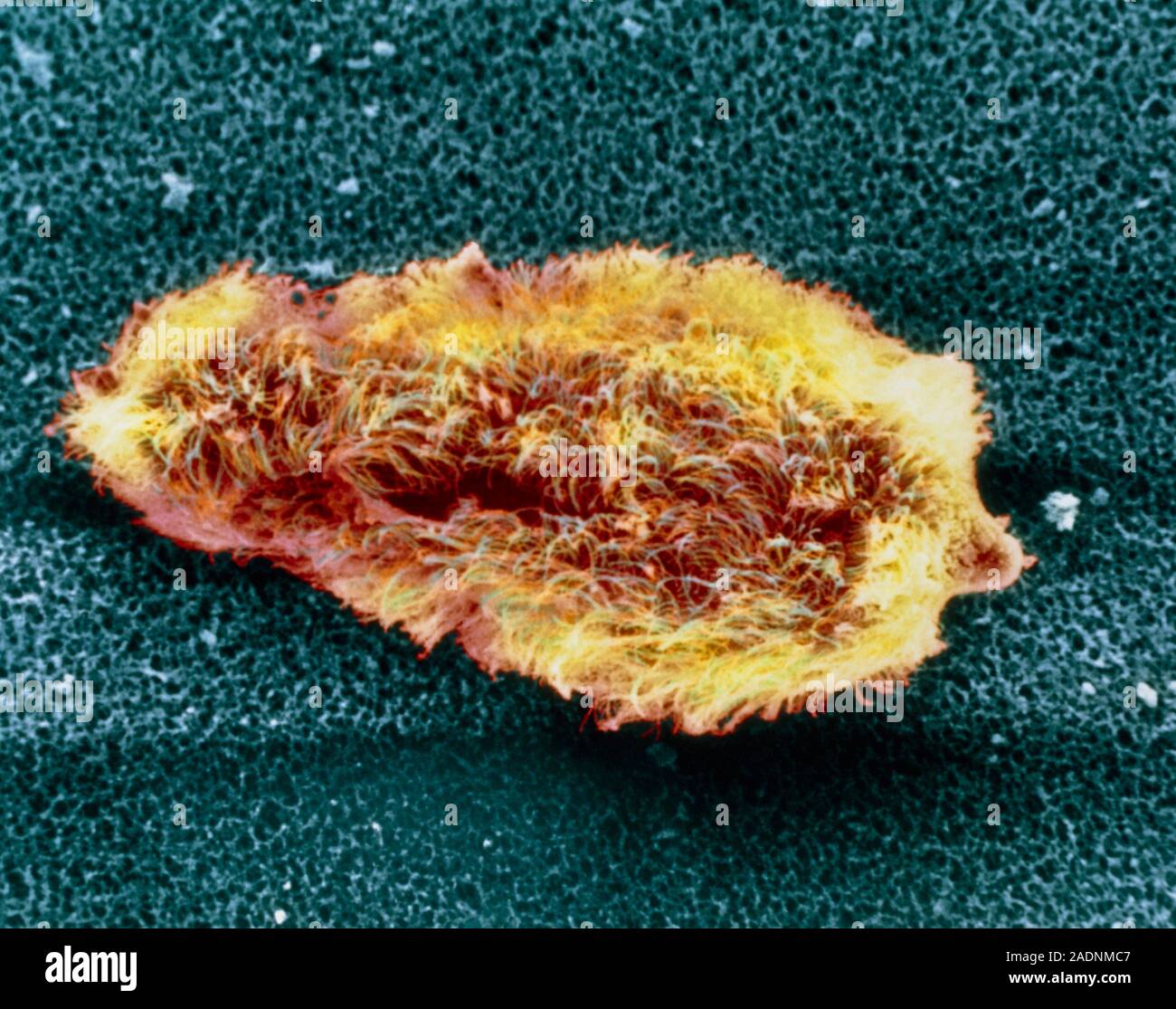 Parasite miracidium. Coloured scanning electron micrograph (SEM) of a ...