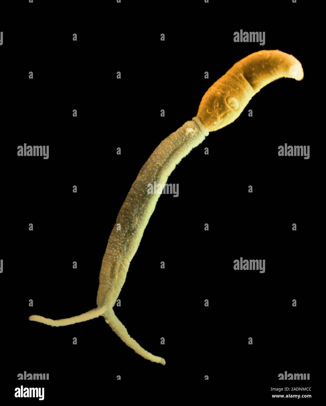 Parasite cercaria. Coloured scanning electron micrograph (SEM) of a ...