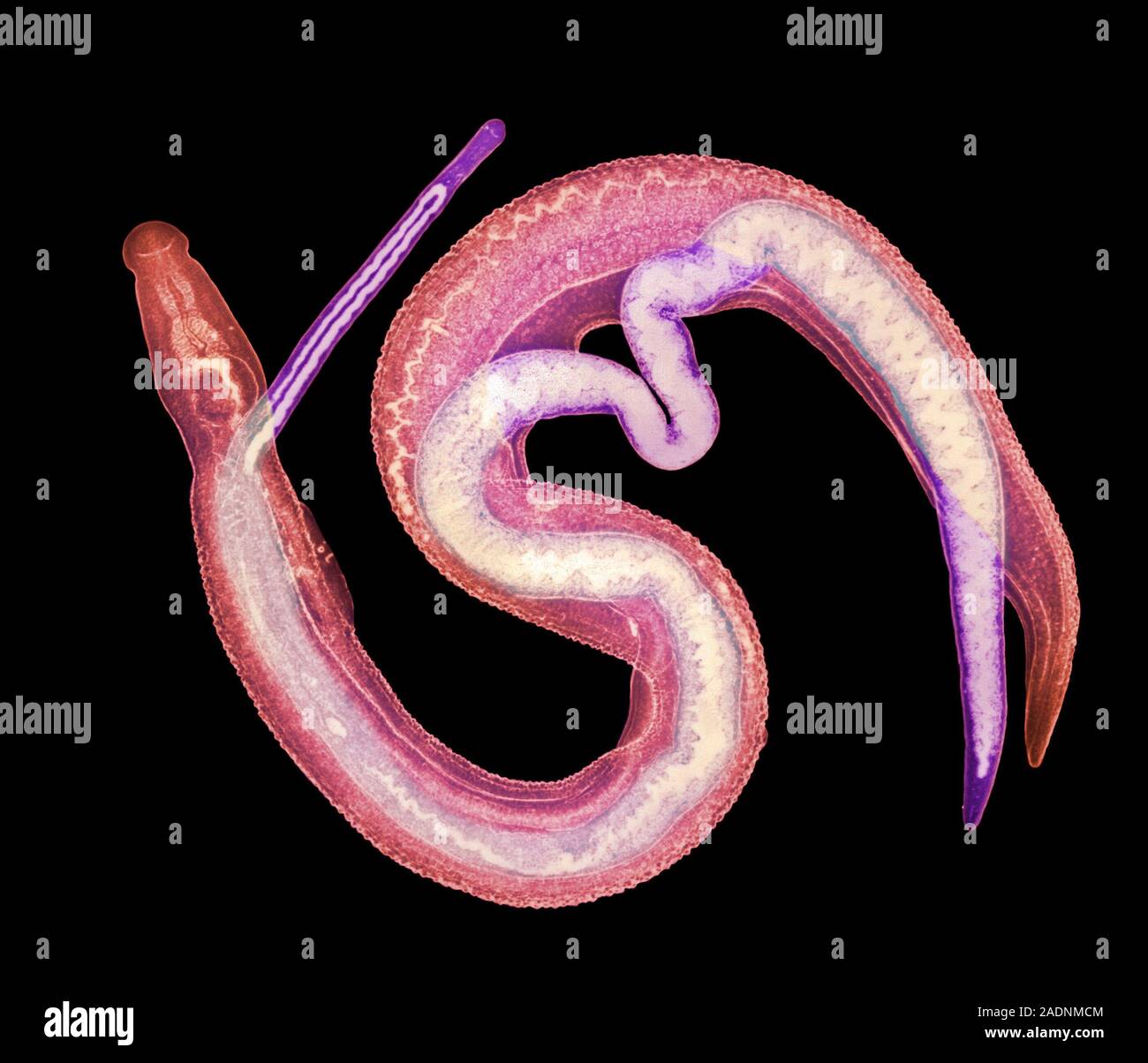 Schistosome parasites. Computer-enhanced light micrograph of adult ...