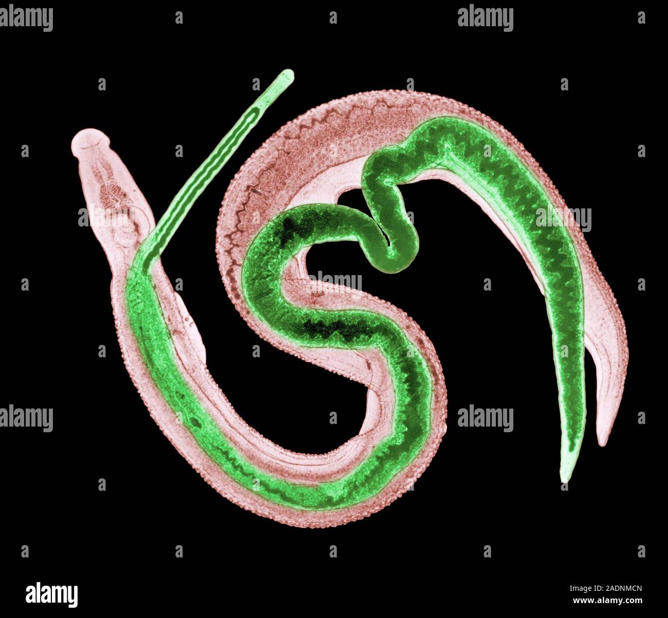 Schistosome parasites. Computer-enhanced light mi- crograph of adult ...