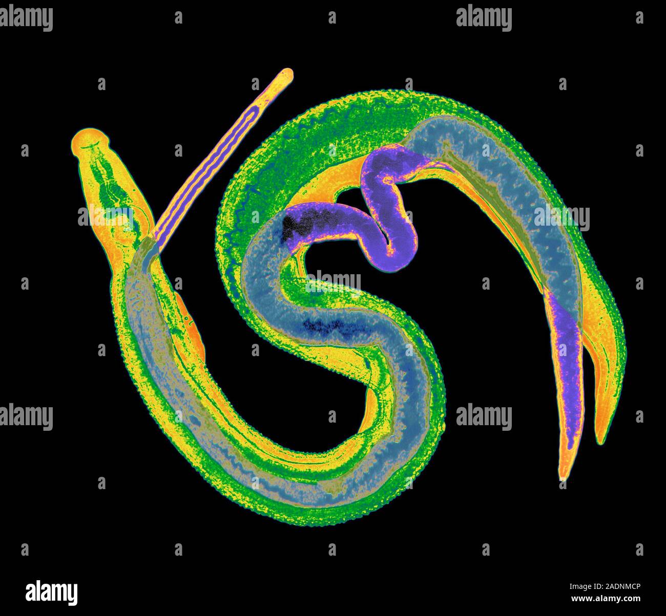 Schistosome parasites. Computer-enhanced light micrograph of adult male ...