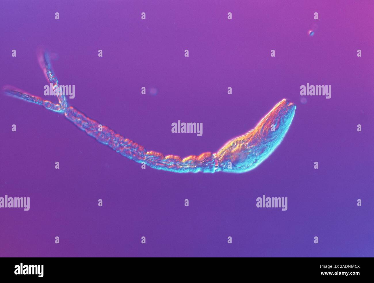 Schistosome parasite. Light micrograph of a cercaria of the fluke ...