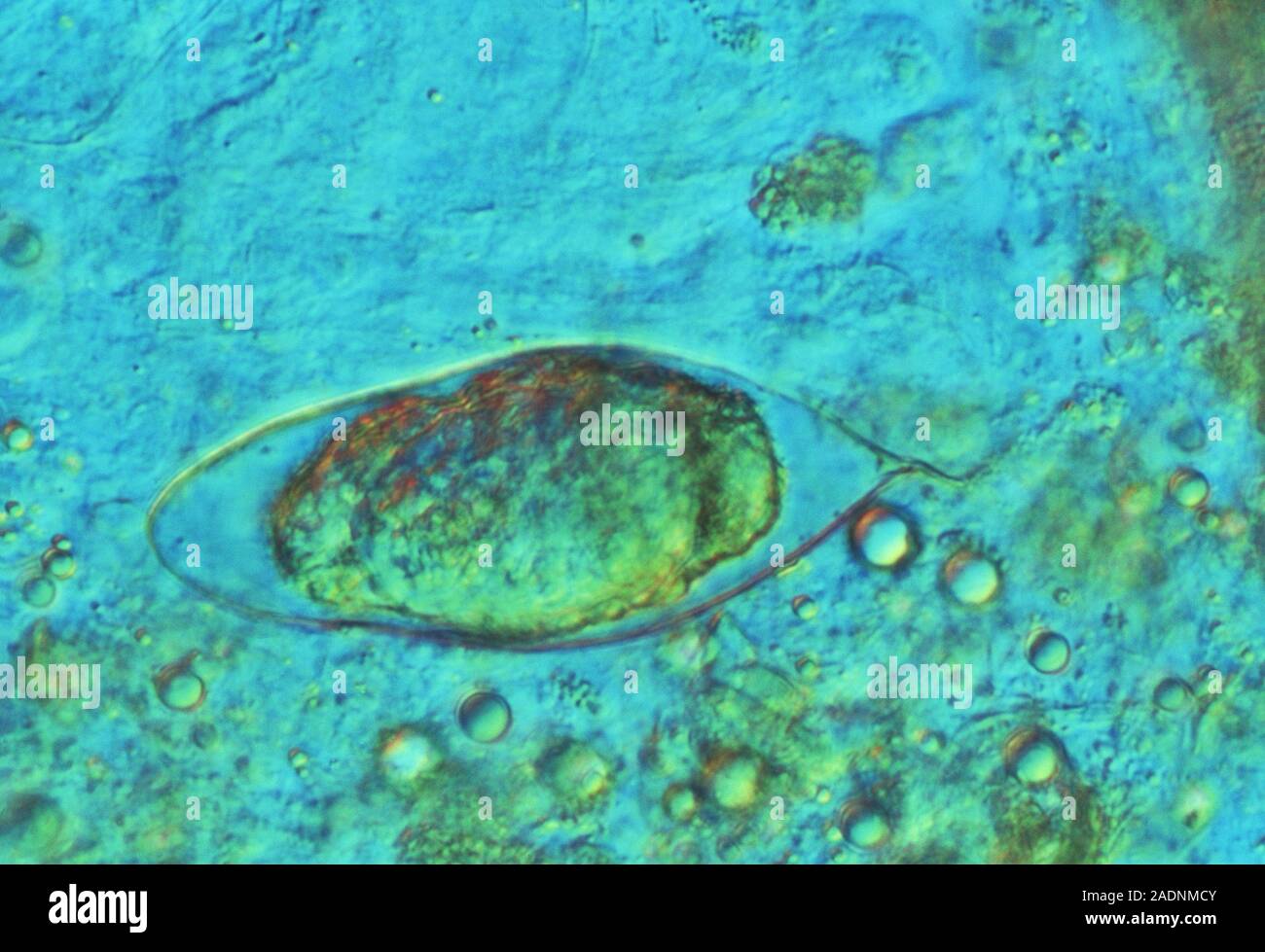 Schistosome egg. Light micrograph of an egg of the fluke Schistosoma haematobium, the cause of ...