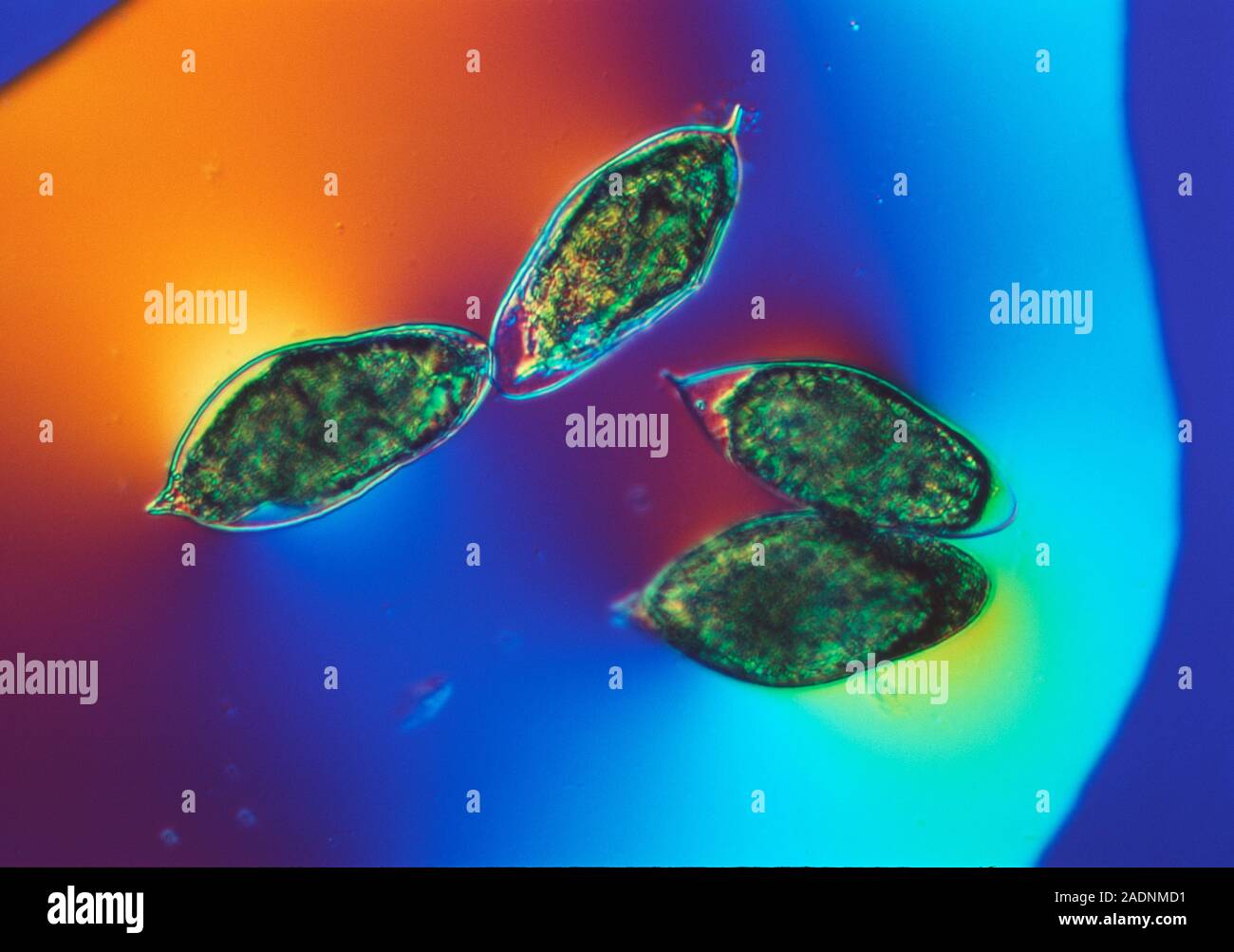 Schistosome eggs. Light micrograph of eggs from the fluke Schistosoma ...