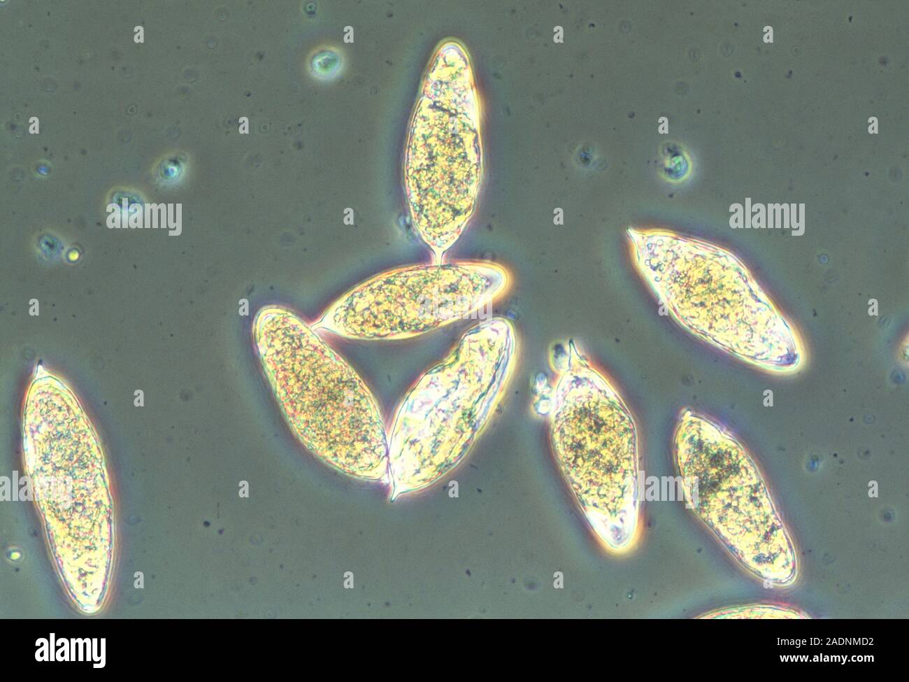 Schistosome eggs. Light micrograph of eggs from the fluke Schistosoma ...