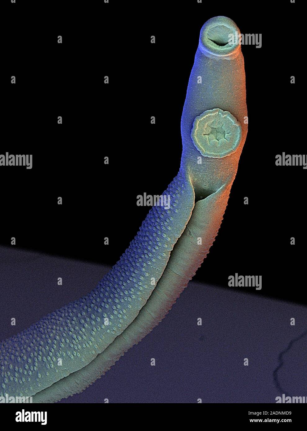 Male schistosome fluke. Coloured scanning electron micrograph (SEM) of ...