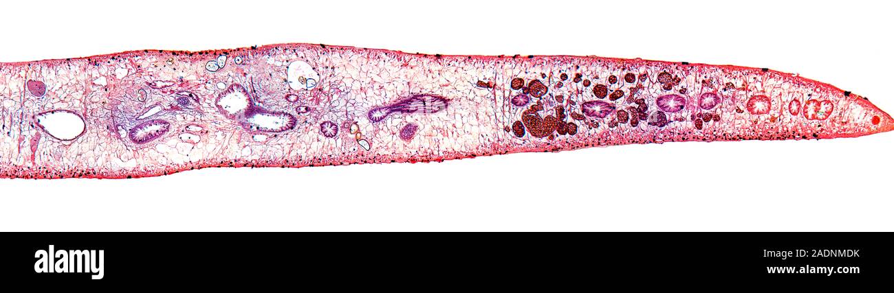 Liver fluke. Light micrograph of a transverse section through the ...