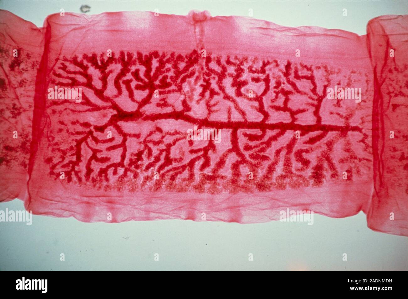 Tapeworm. Light micrograph of a unit (proglottid) from the body ...