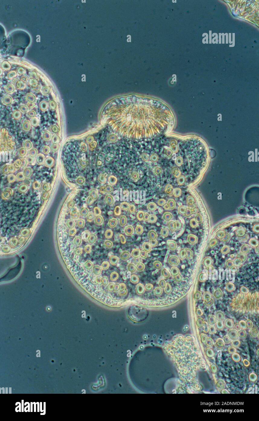 Light micrograph of the larval form of the dog tapeworm Echinococcus ...