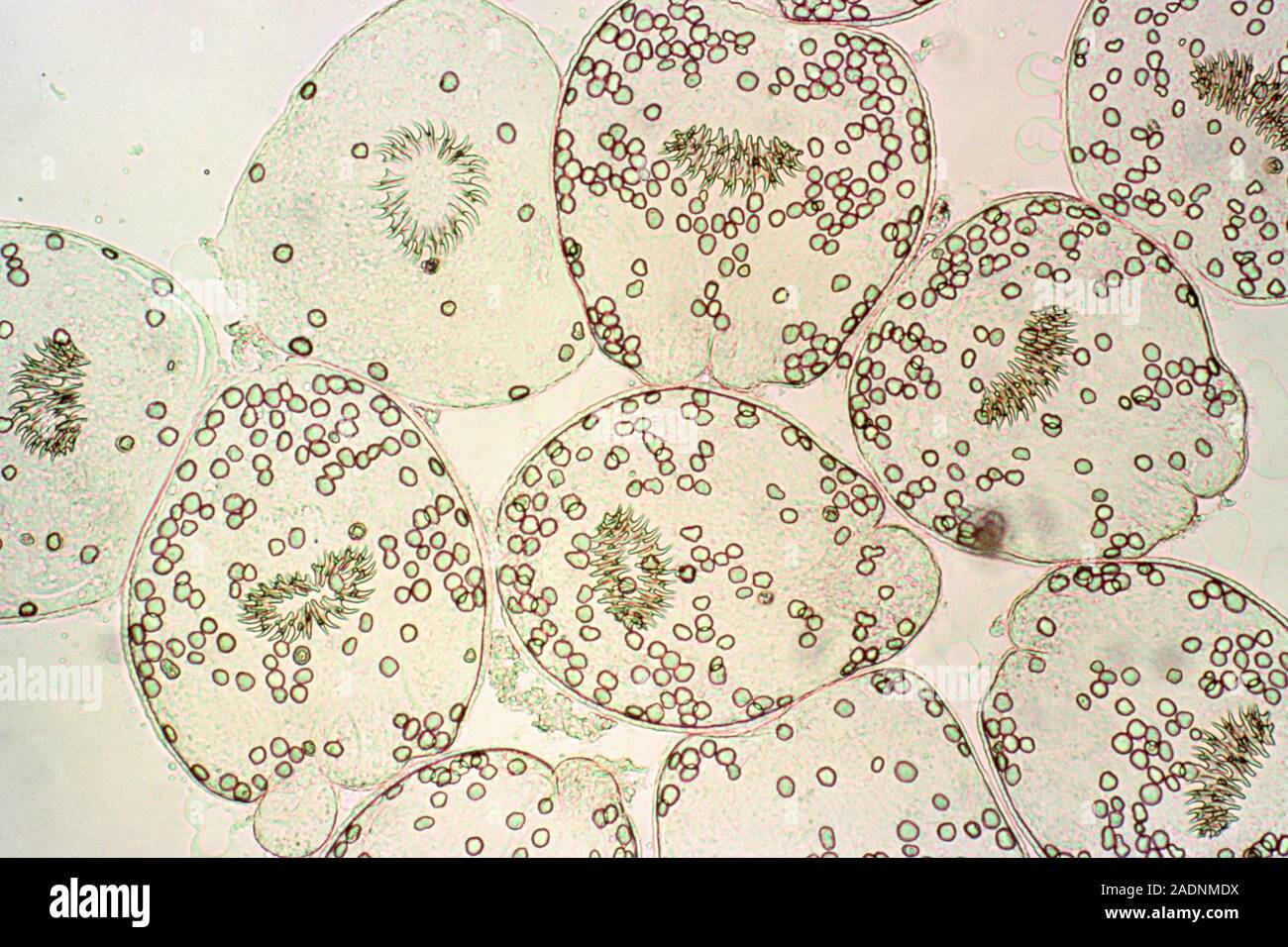 Light micrograph of the larval form of the dog tapeworm Echinococcus ...