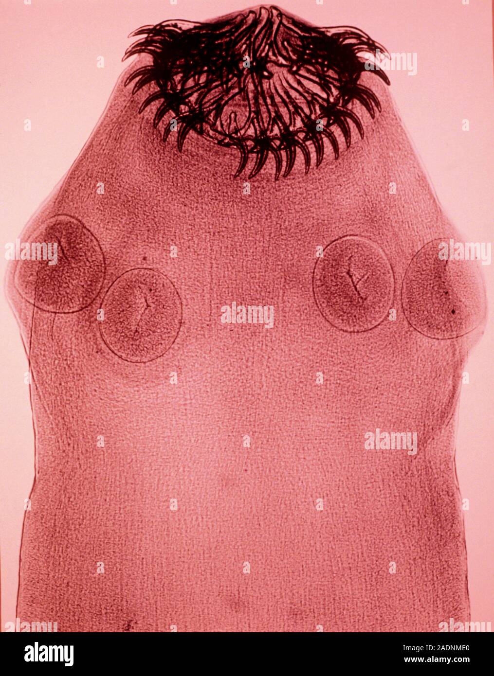 False-colour light micrograph of the scolex (head) of the adult pork ...