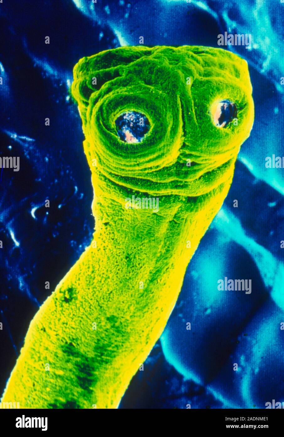 False-colour scanning electron micrograph (SEM) of the head (scolex ...