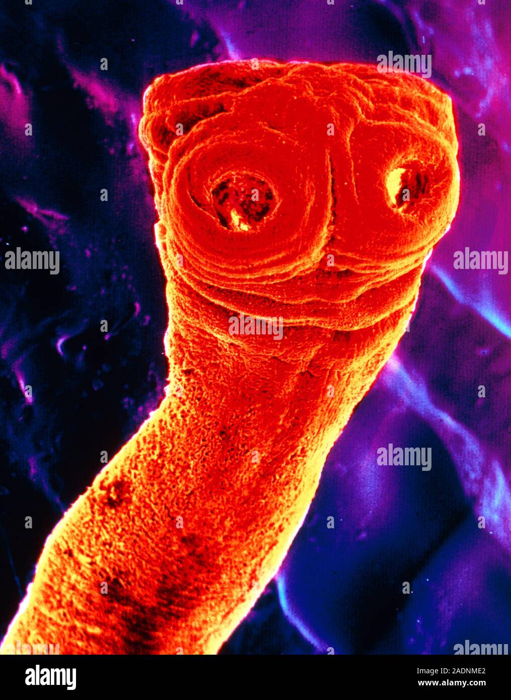 False-colour scanning electron micrograph (SEM) of the head (scolex ...