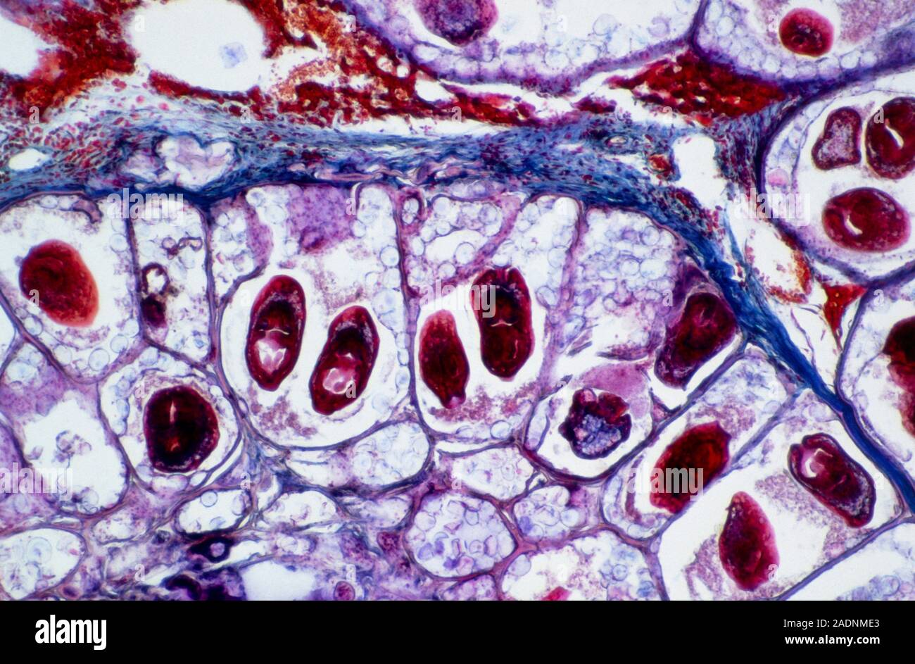Light micrograph of a section of beef tongue containing the encysted ...