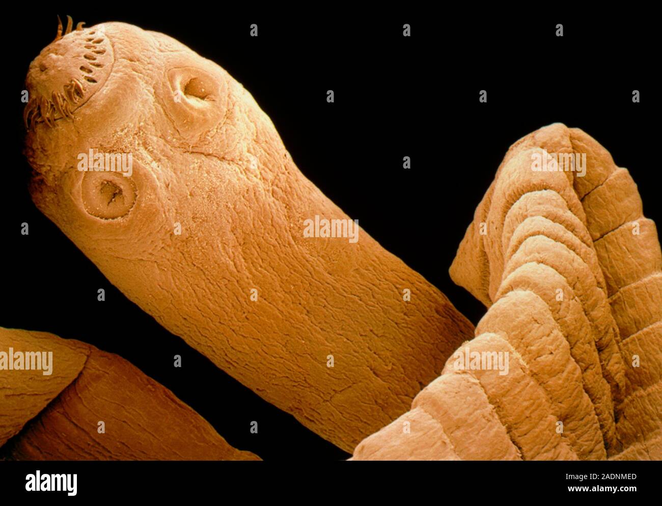 Tapeworm. Coloured scanning electron micrograph (SEM) of the head ...
