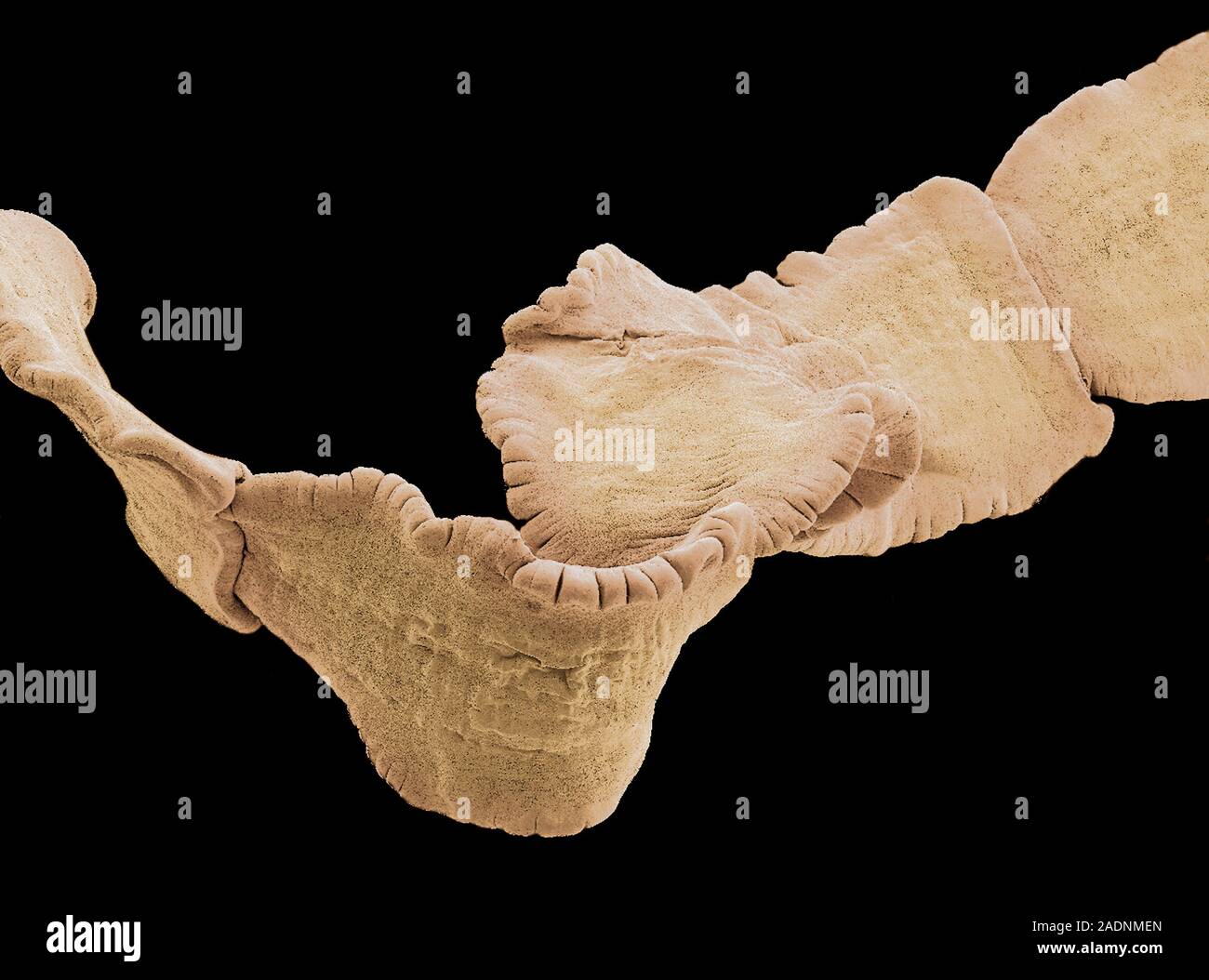 Dog tapeworm. Coloured scanning electron micrograph (SEM) of body ...