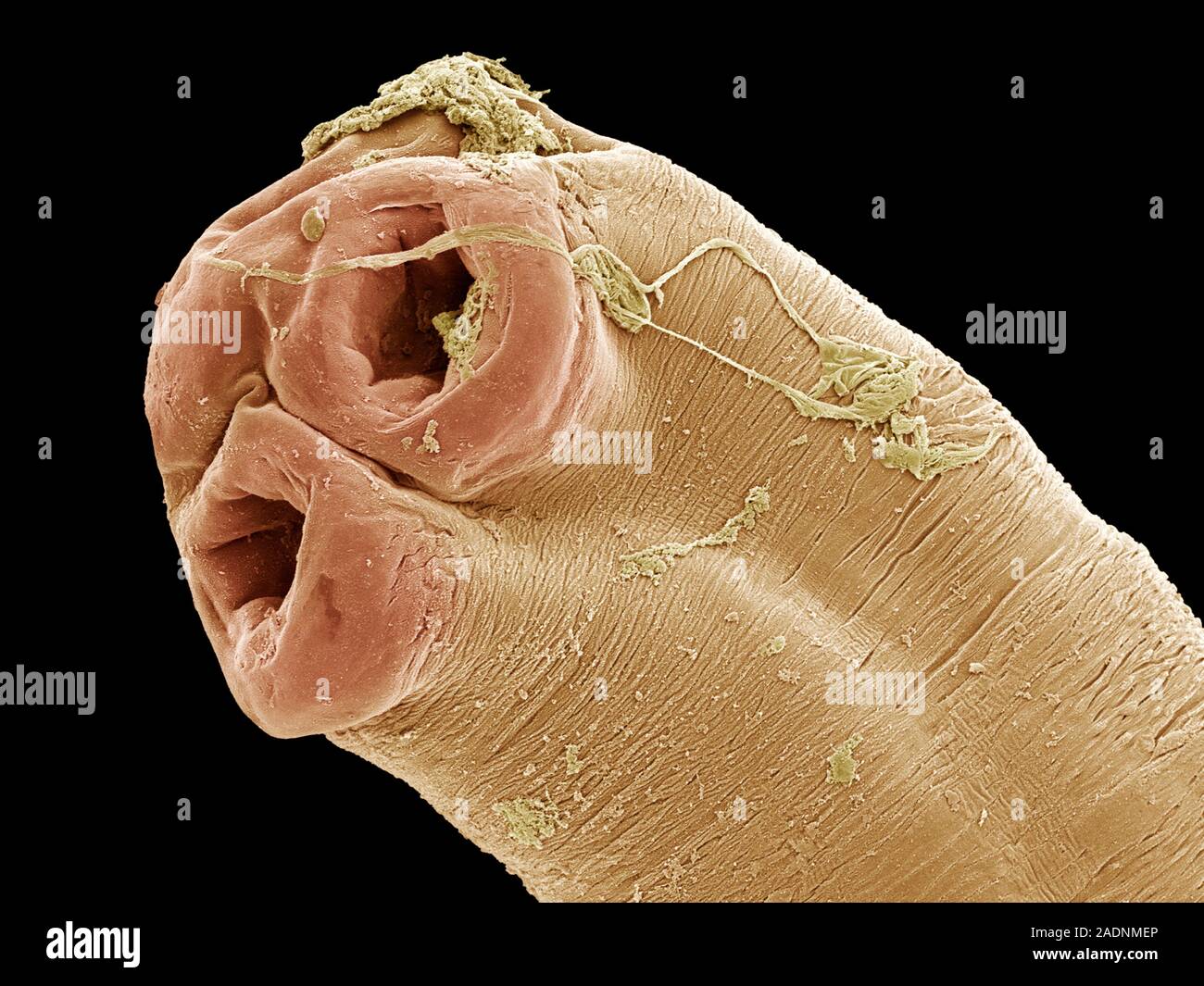 Cobra tapeworm. Coloured scanning electron micrograph (SEM) of the head ...