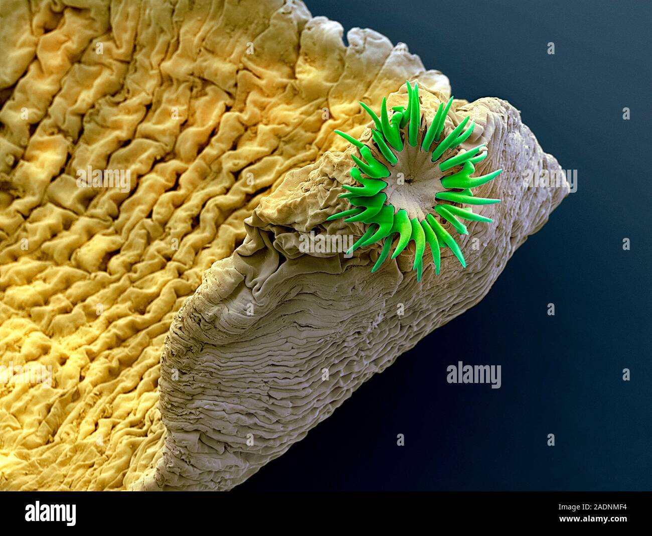 Dog tapeworm (Taenia pisiformis), coloured scanning electron micrograph ...