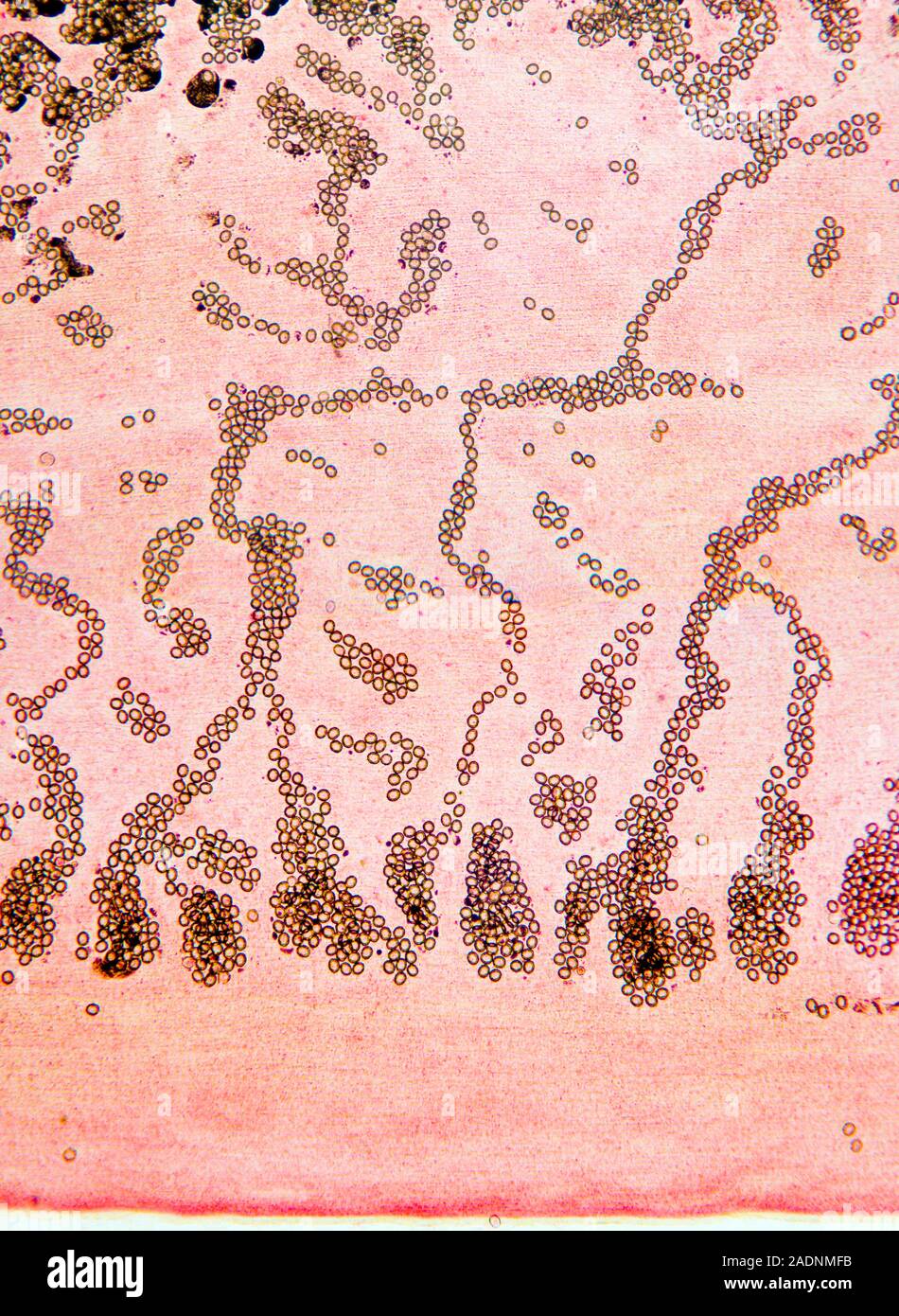 Pork tapeworm proglottid. Light micrograph of a section through a ...