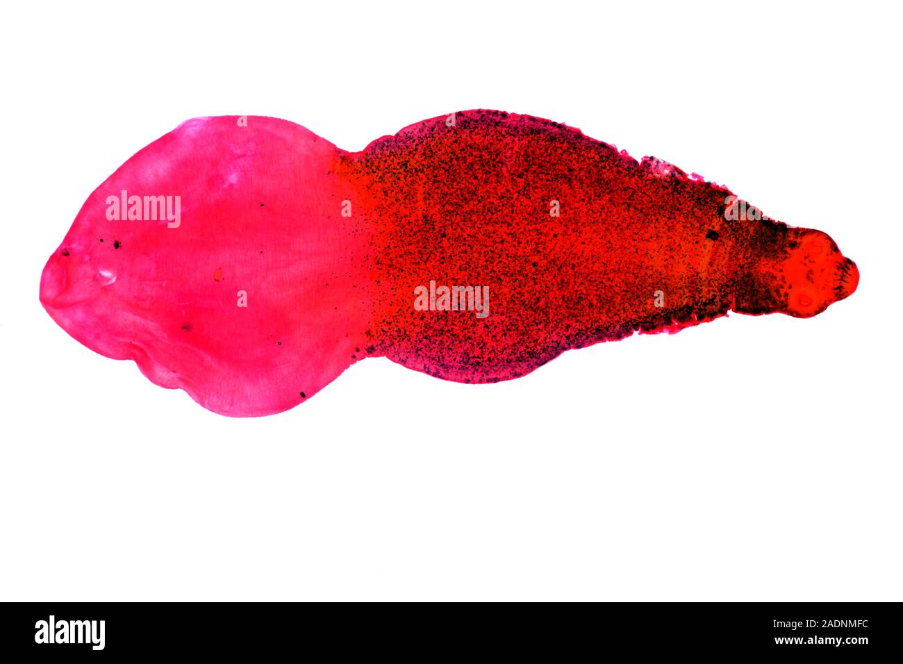 Tapeworm cysticercus. Light micrograph of the bladder worm or ...