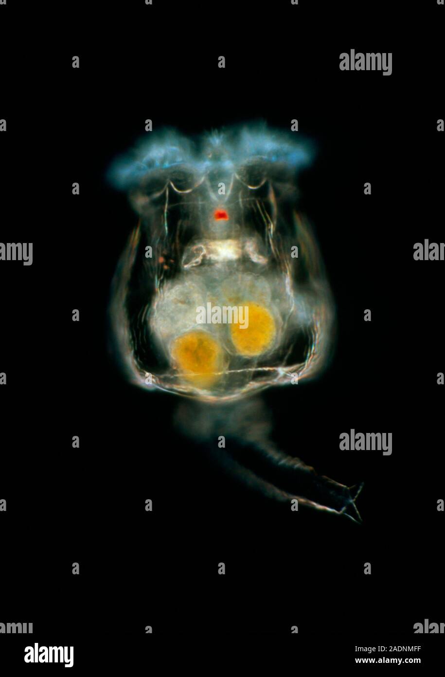 Light micrograph of a common rotifer (roundworm family) Brachionus sp ...