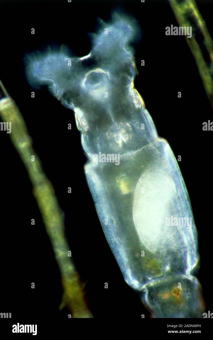 Light micrograph of a common rotifer Philodina sp., seen between tow ...