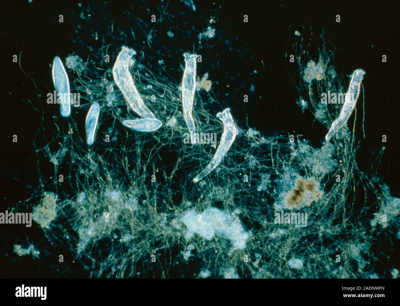 Light micrograph of several Bdelloid rotifers Rotaria sp. seen next to ...