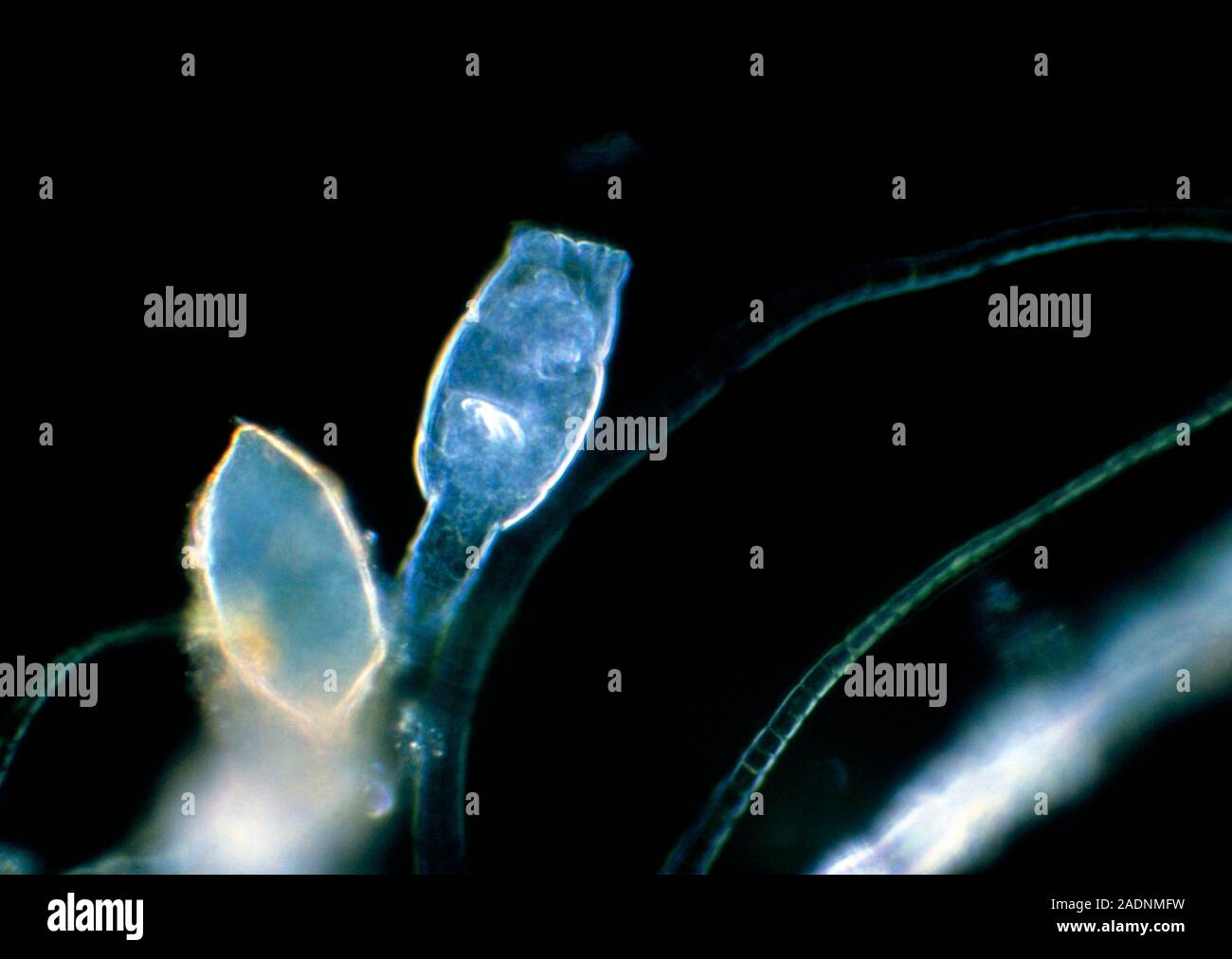 Light micrograph of the hatching of the rotifer Adineta sp. The picture ...