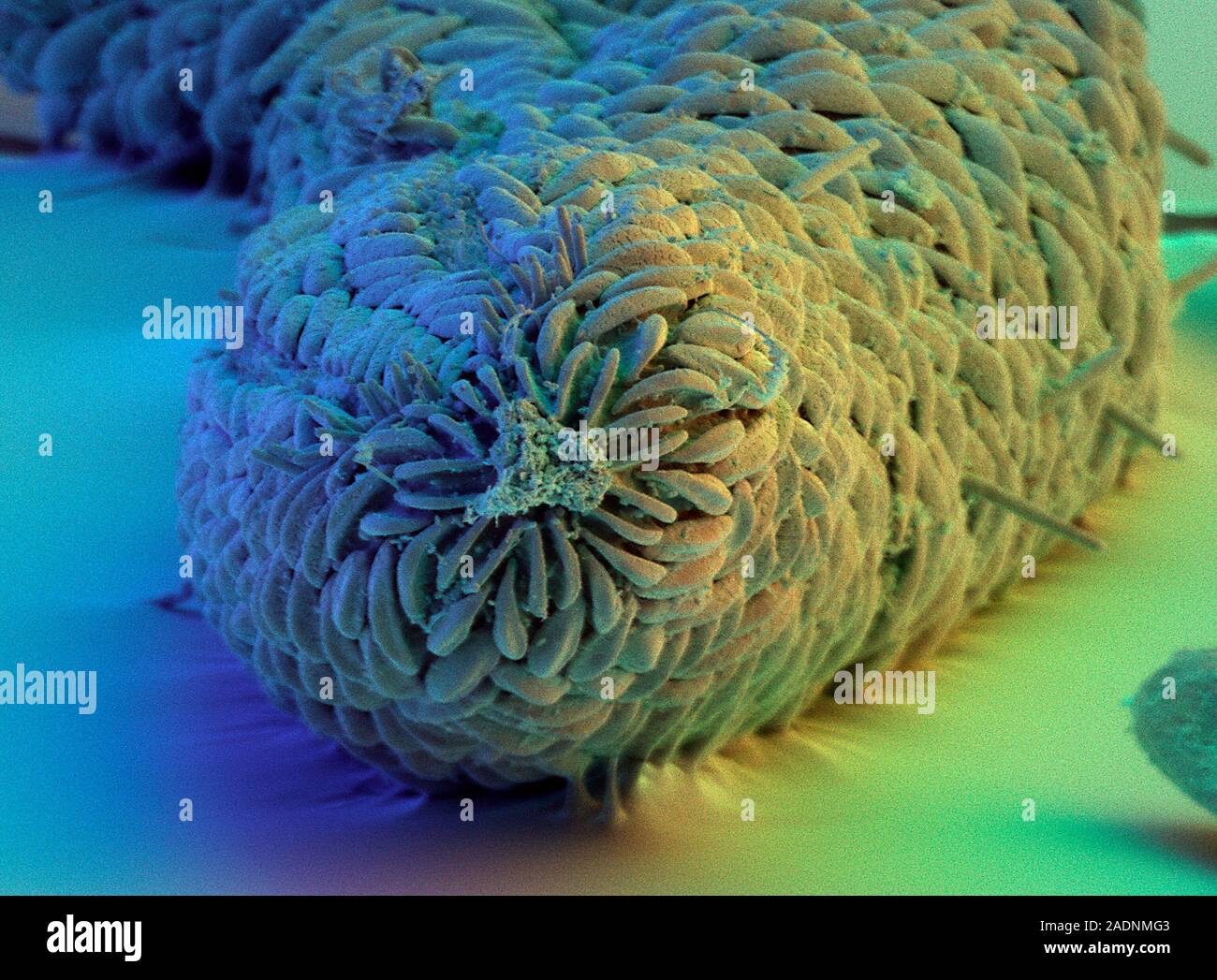 Lepidodasys. Coloured Scanning Electron Micrograph (SEM) of the mouth ...
