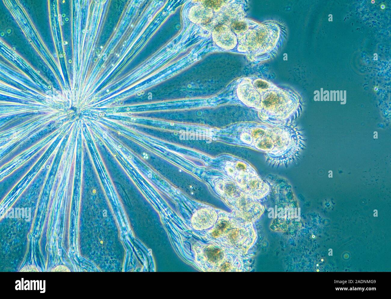 Rotifer colony. Light micrograph of a colony of Conochilus hippocrepis ...