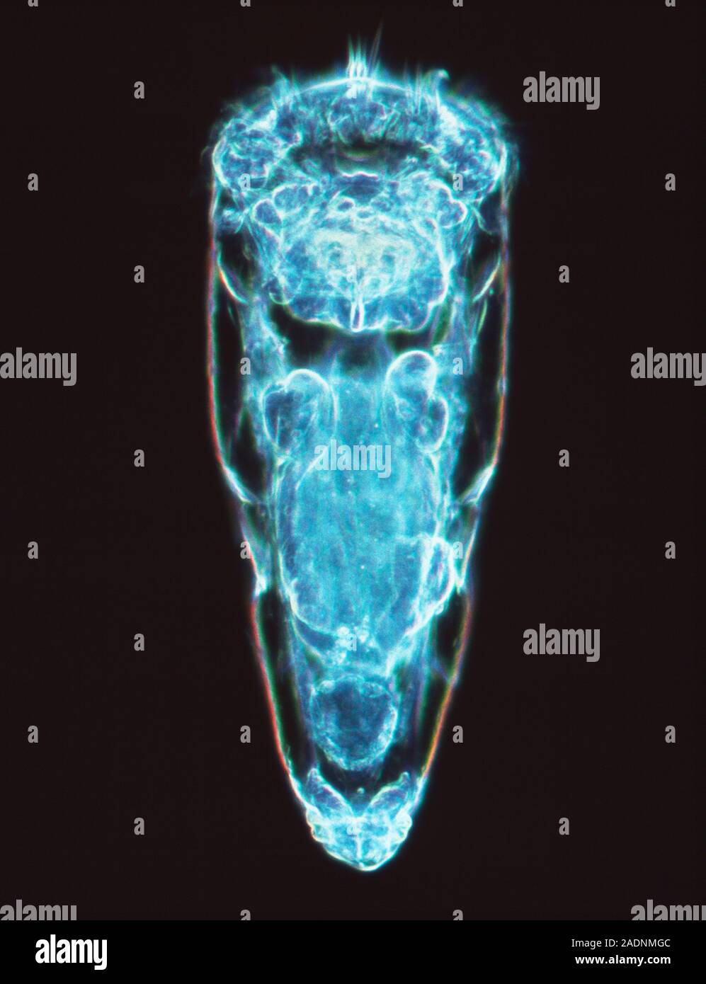 Rotifer worm. Light micrograph of an unidentified rotifer worm (phylum ...