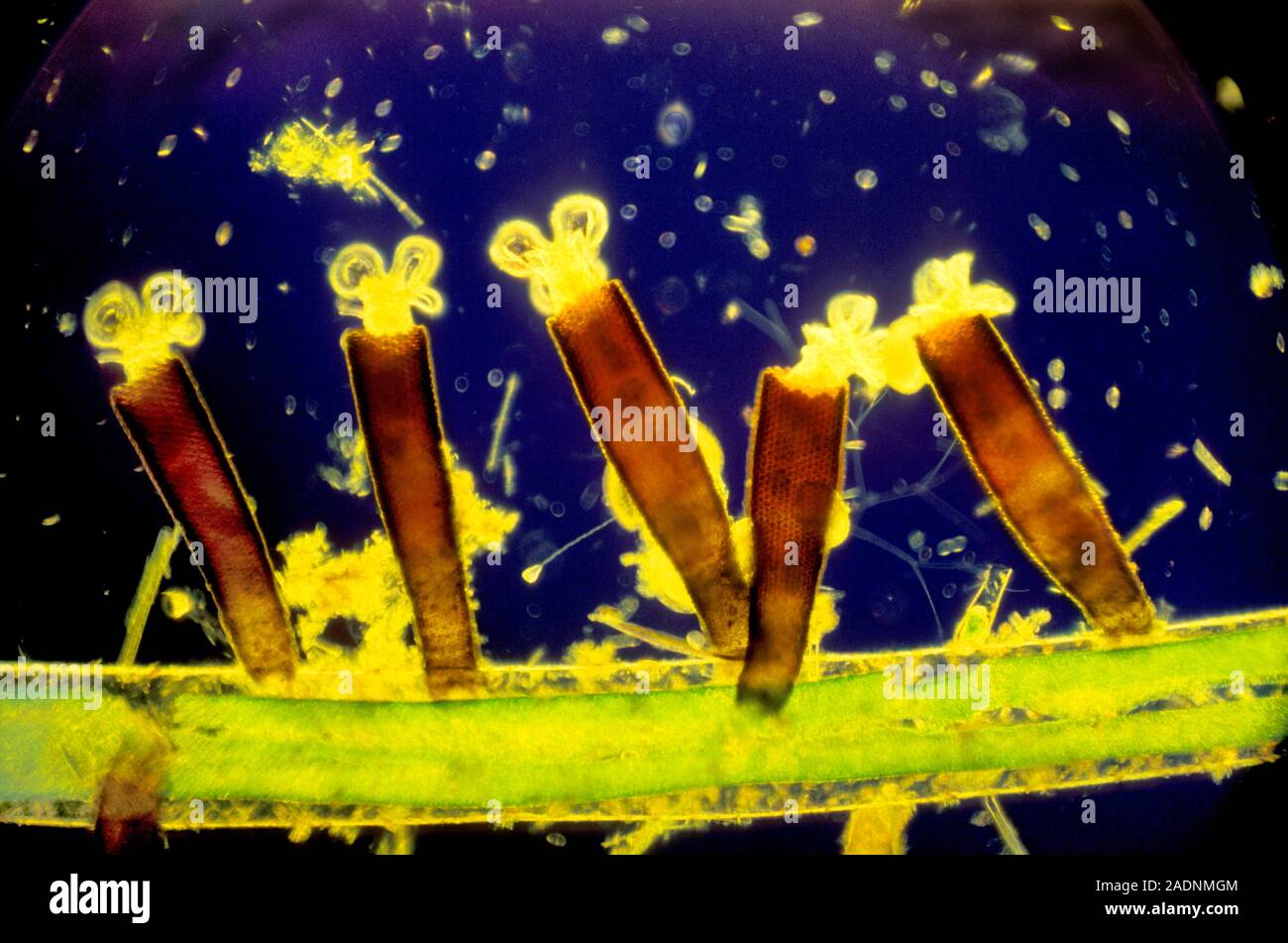 Sessile rotifers. Light micrograph of five rotifers (Floscularia ...