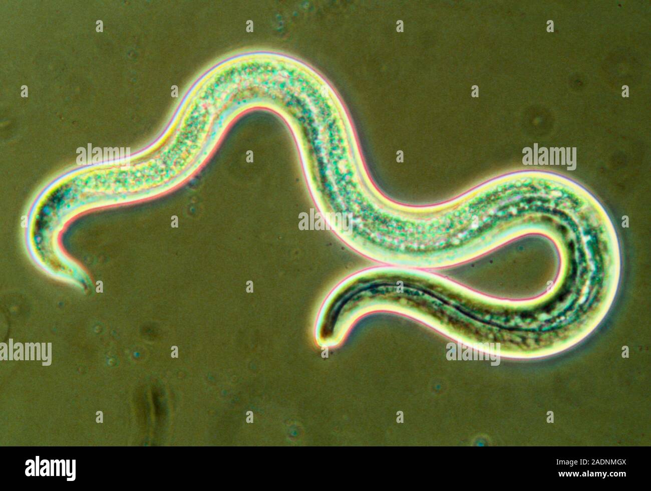 Light micrograph of the first larval stage of the dog roundworm ...