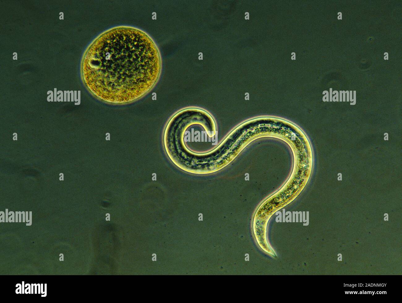 Light micrograph of an egg & 1st larval stage of the dog roundworm ...