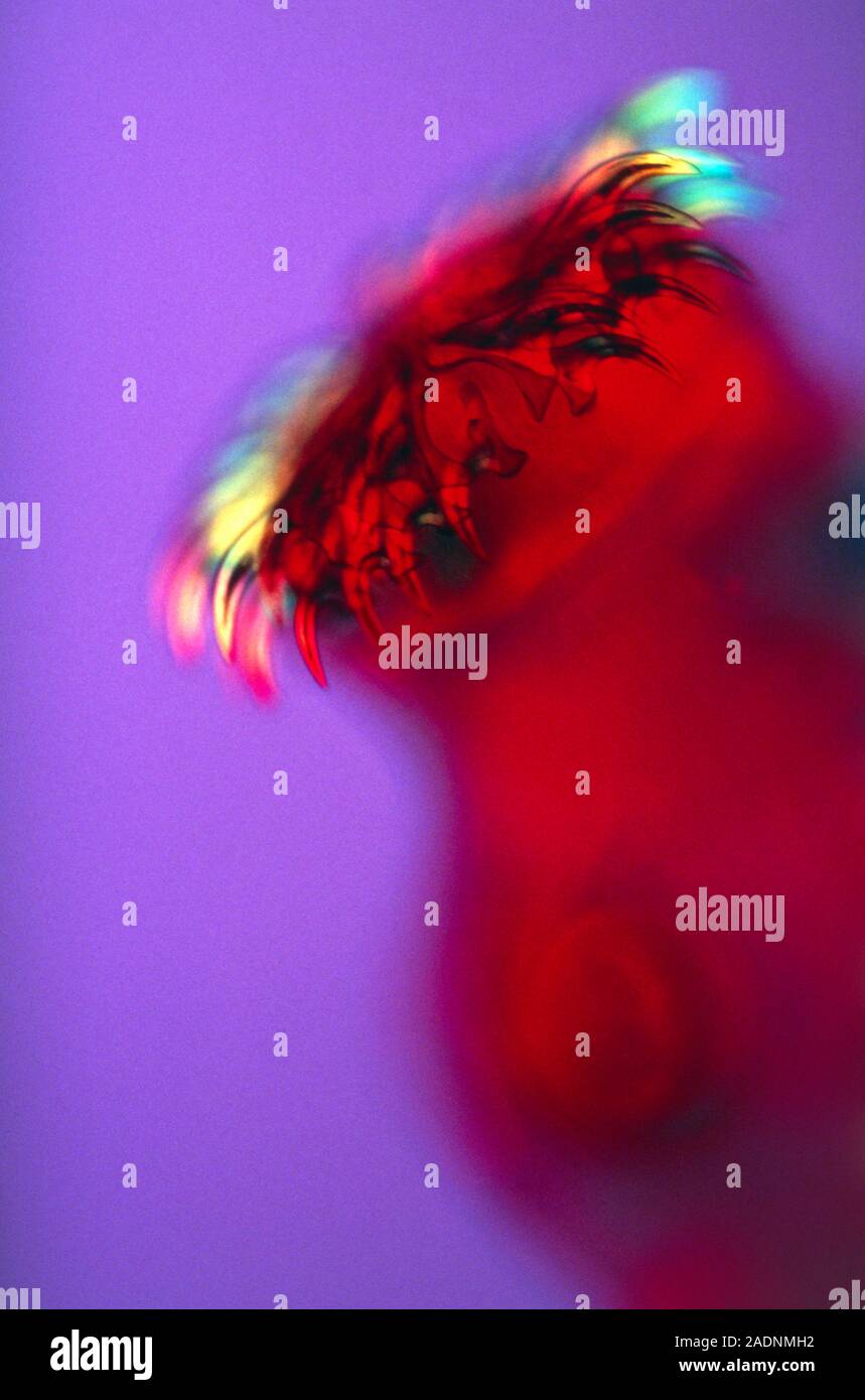 Polarised light micrograph showing the head of the hookworm Ancylostoma ...