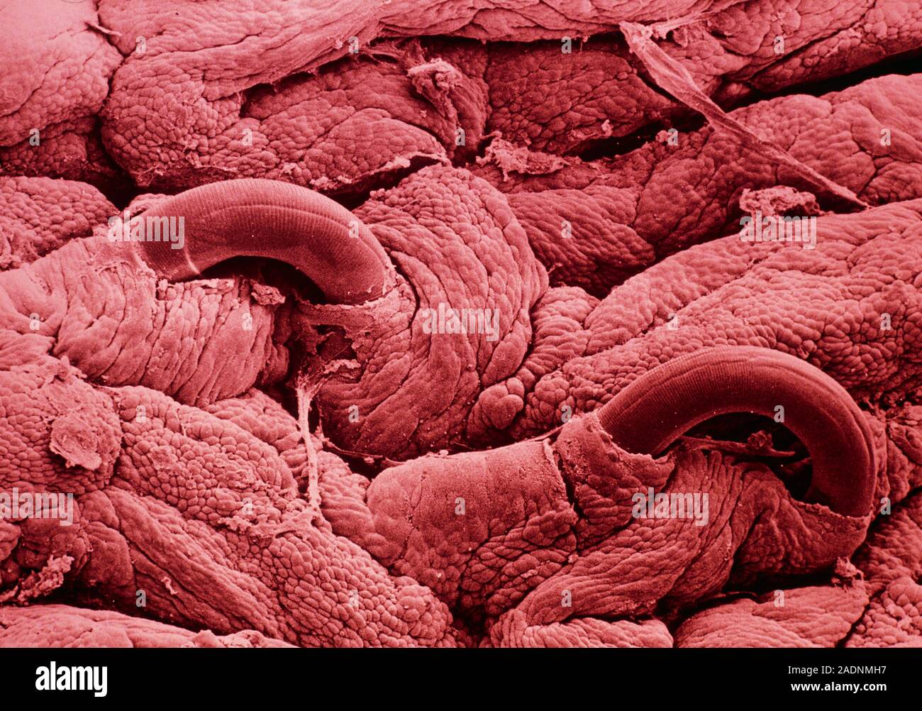 False Colour Scanning Electron Micrograph Sem Of The Threadworms Trichostrongylus Vitrinus In