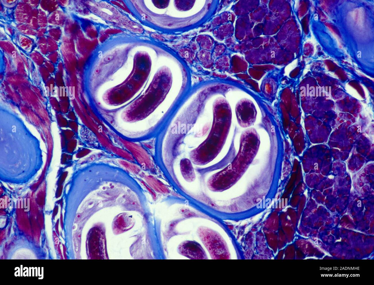 Light micrograph of Trichina spiralis (formerly called Trichinella ...
