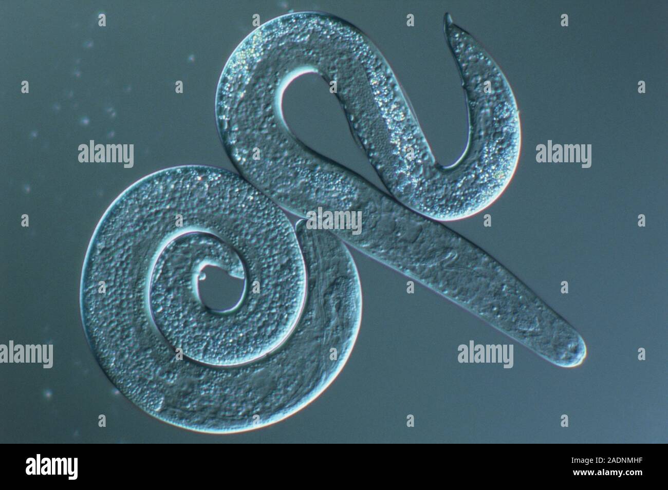 Light micrograph of two specimens of the dog roundworm Toxocara canis ...