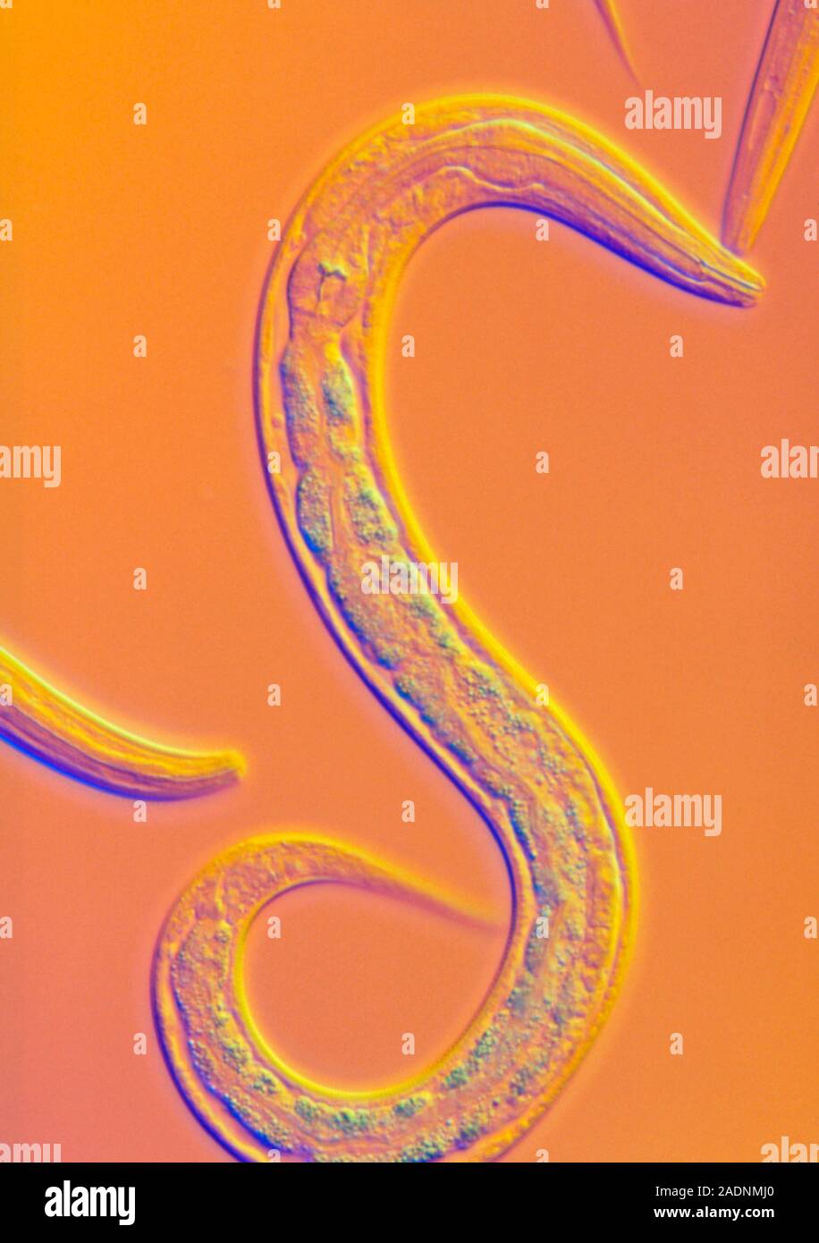 Caenorhabditis elegans nematode worm, light micrograph. This soil-dwelling hermaphrodite ...