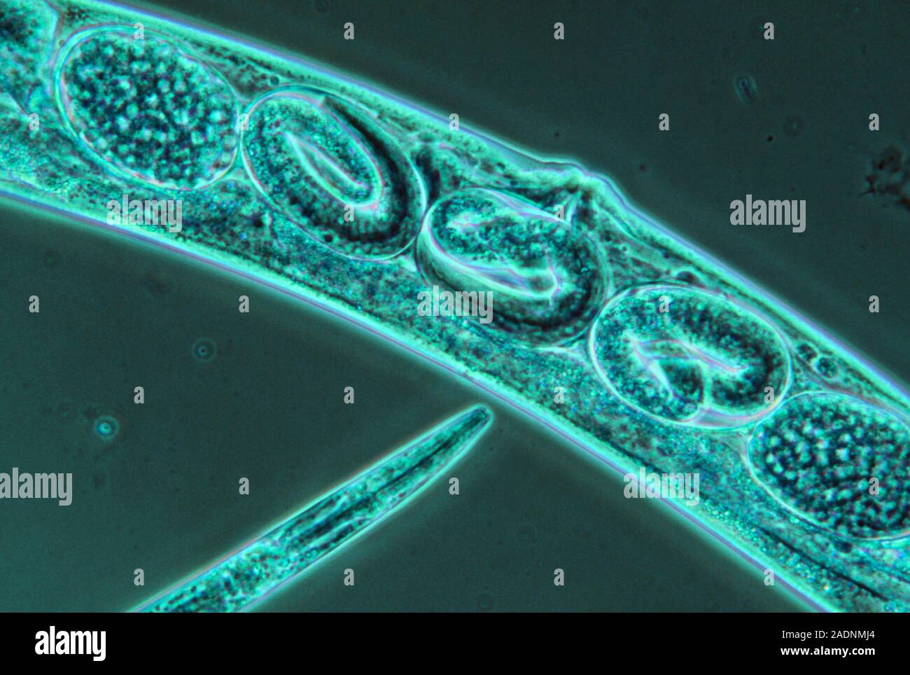 Light micrograph of an adult Caenorhabditis elegans, a soil-dwelling bisexual nematode worm that ...
