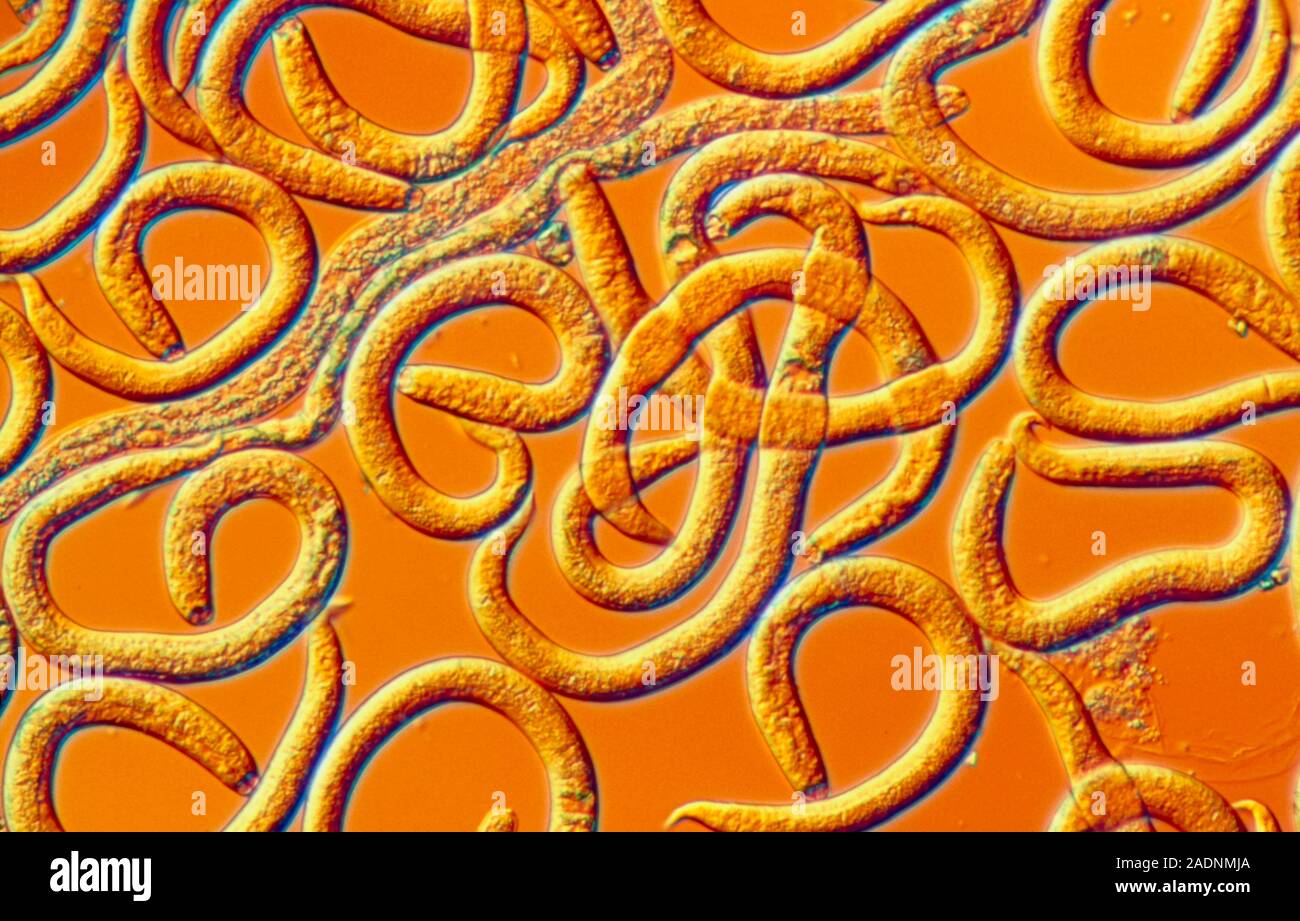 Light micrograph of the nematode worm, Toxocara vitalorum. Nematodes ...