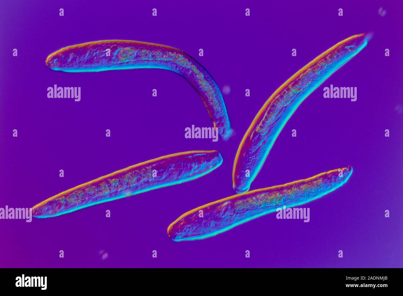 Light micrograph of the larval stage of the nema- tode worm, Toxascaris ...