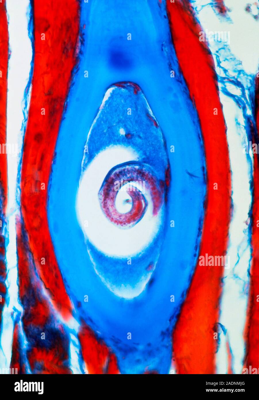 Trichinella larva. Light micrograph of a Trichin- ella spiralis larva ...