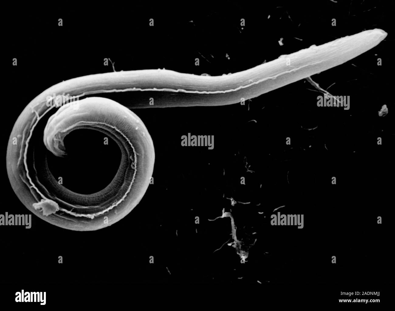 Toxocara canis. Scanning electron micrograph of the nematode (roundworm ...