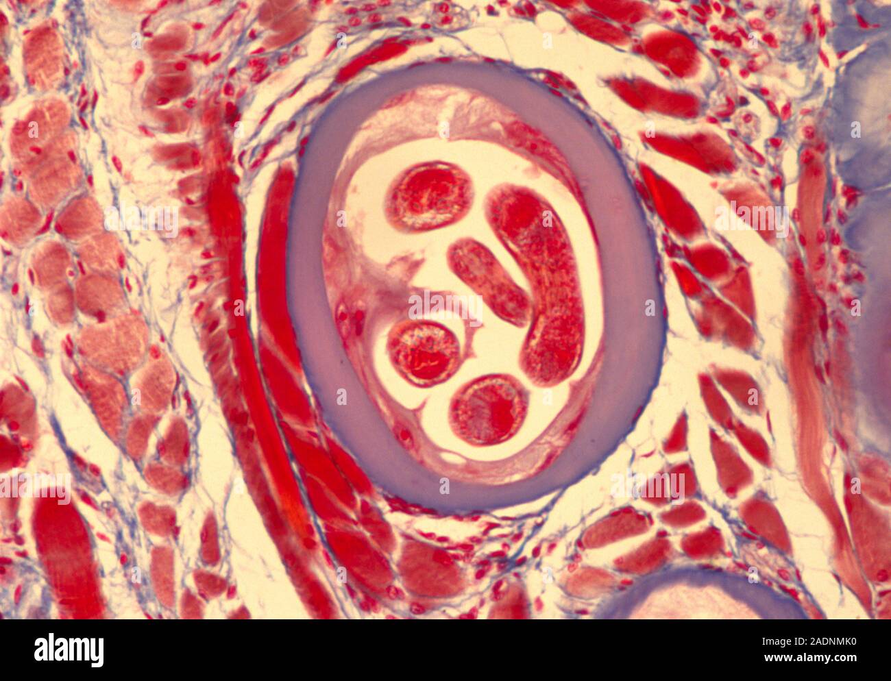 Trichinella spiralis. Light micrograph of a section though pork muscle ...