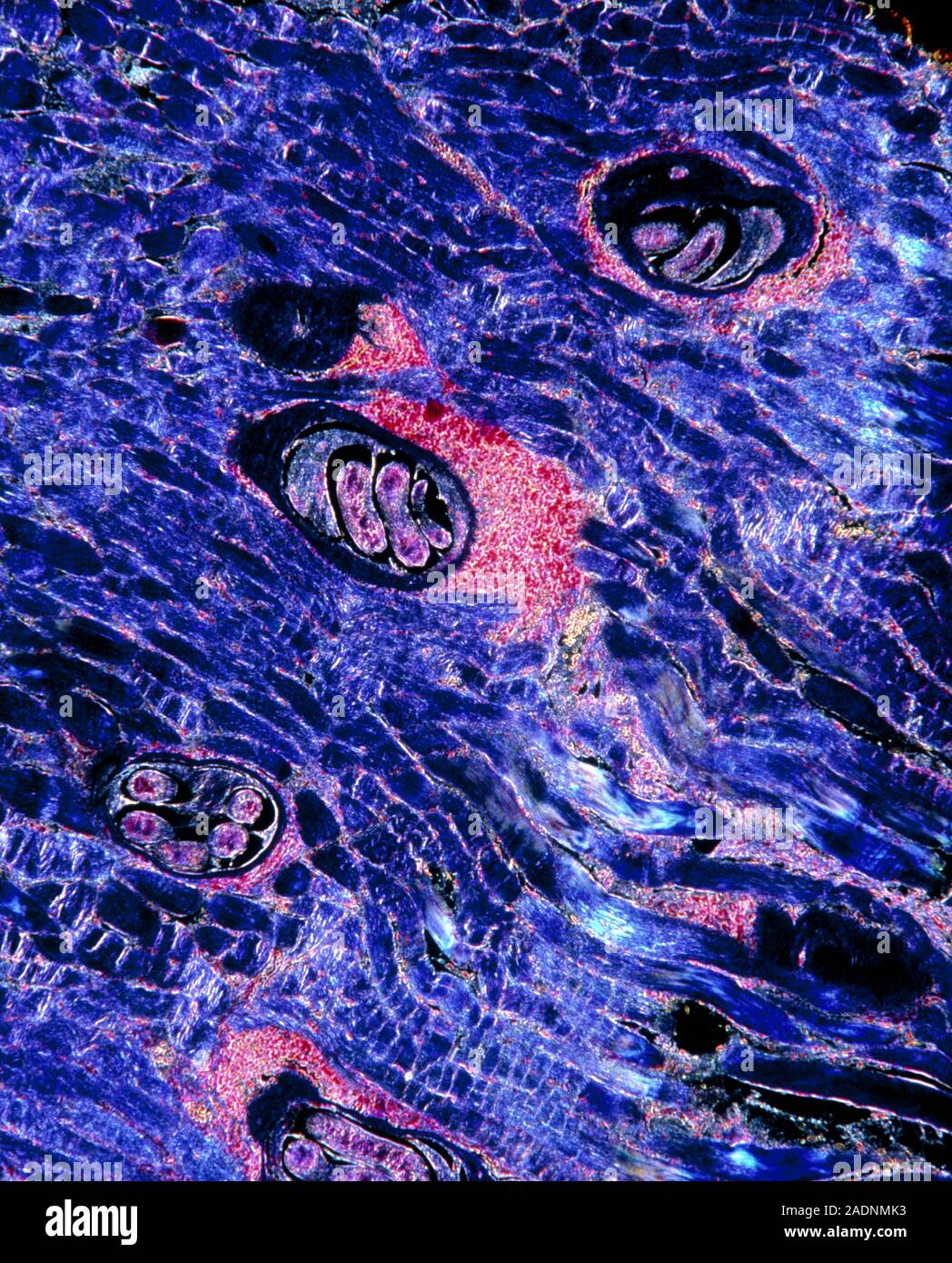 Trichinella spiralis. Light micrograph of a section through cysts ...